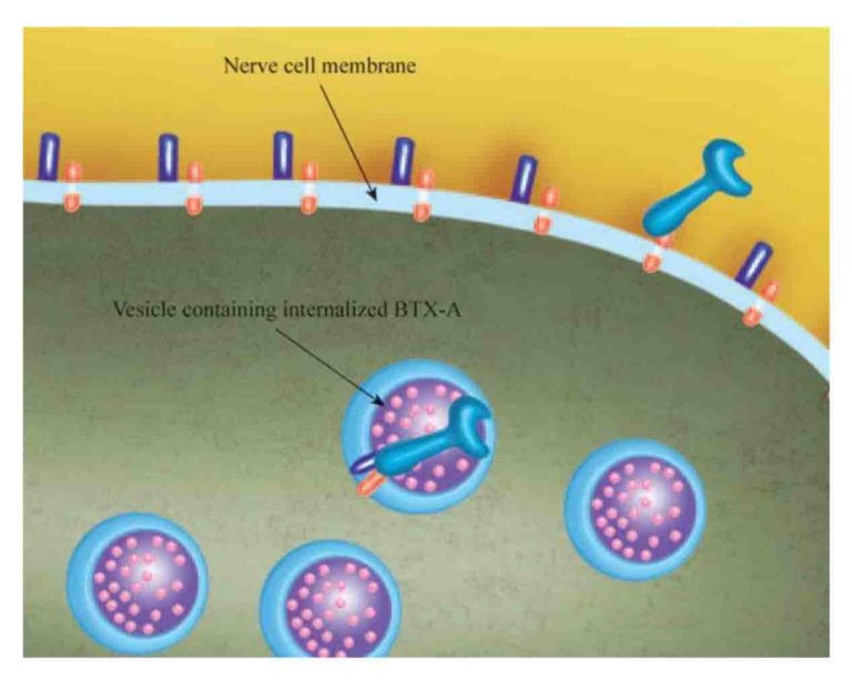 Unit 4: Introduction To Botulinum Toxin & Mechanism Of Action – Vindoc ...